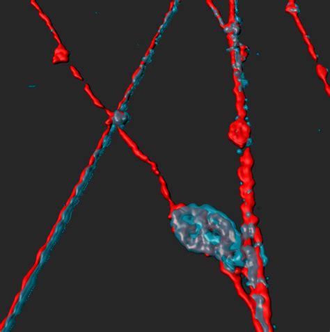 Axonal Regeneration In Motor Neurons Derived From Human Ipscs Crestoptics
