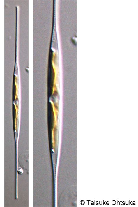 Nitzschia Draveillensis