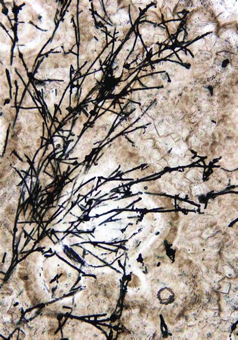 Microscopic Image Of A Fungus Like Filamentous Microfossils Preserved Download Scientific