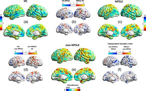 Whole Brain Tsa Maps A C E Group Tsa Maps In Healthy Controls Hc