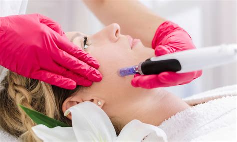 Nucell Skin Medspa From 35910 San Jose Groupon