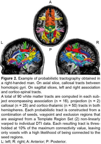 Cnrs Innovation New Tools To Investigate Hemispheric Specialization