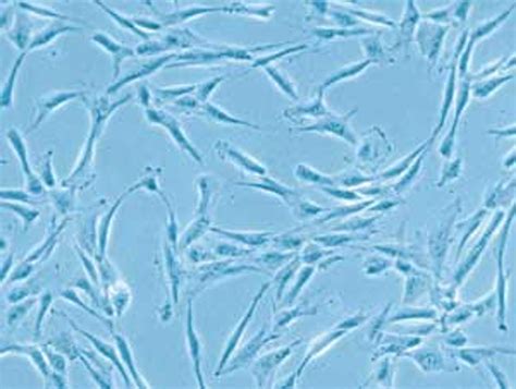 Mesenchymal Stem Cell Cultivation In Single Use Stirred Tank Bioreactors