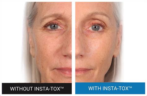 Serious Skincare Insta Tox Reviews Is It Worth The Money