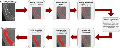 Processing Pipeline For Binarizing The Tmc Joint From Hr Pqct Scans
