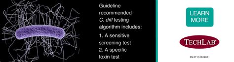 Calibration Verification Linearity The Mislabeled Specimen Lab