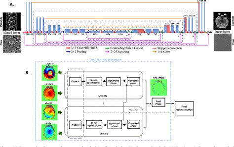 Figure 1 From Deep Learning Based Multiplexed Sensitivity Encoding Dl Muse For High Resolution