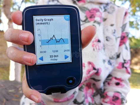 Girl With Diabetes Is Reading The Glucose Levels Using Device For Continuous Glucose Monitoring
