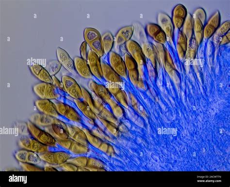 Light Micrograph Of Teliospores Of Hollyhock Rust Puccinia Malvacearum Fungus Mycelium Stained