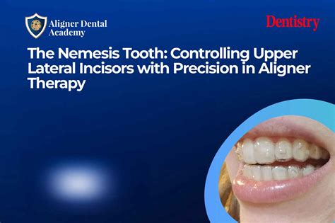 Lateralincisorshome Uk