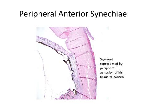 Ppt Clinicopathologic Case Powerpoint Presentation Free Download