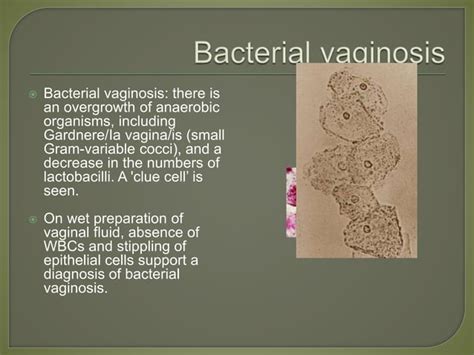 Genital Infections In Gynecology Pptx