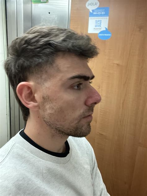 10 Months Oral Min Topic Fin 29 Years Old Rtressless