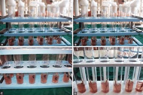 A To D A Files In Test Tubes After Autoclave Sterilization B Download Scientific Diagram