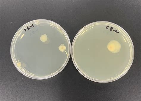 미생물 콜로니 관련 실험 Qanda 커뮤니티 Bric
