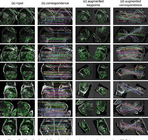 Figure 1 From Keypoint Augmented Self Supervised Learning For Medical