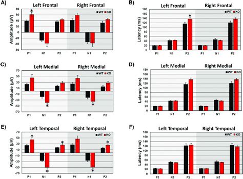 Quantitation Of Auditory Event Related Potential Erp Amplitudes And Download Scientific
