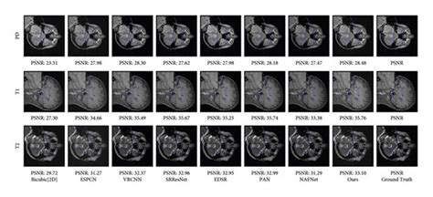 Super Resolution Reconstructed Lr Images Are Obtained By Bicubic