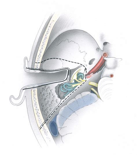 Standard Procedure Skull Base Surgery Atlas