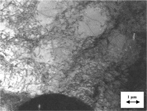Dislocation Substructure In A High Speed Thread Rolled Specimen