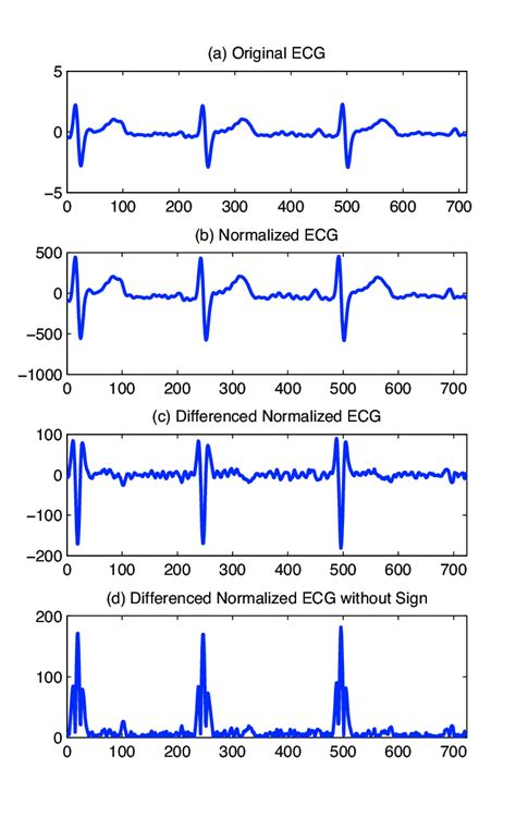 preprocessing stages of ecg compression download scientific diagram