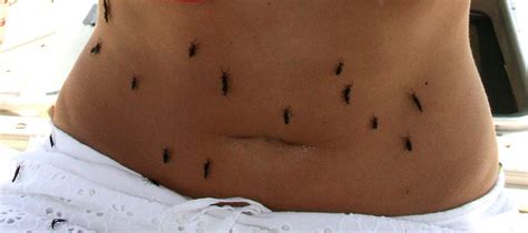 Catch Up Post Enjoying Encore But The Love Bugs Not So Much My Desultory Blog