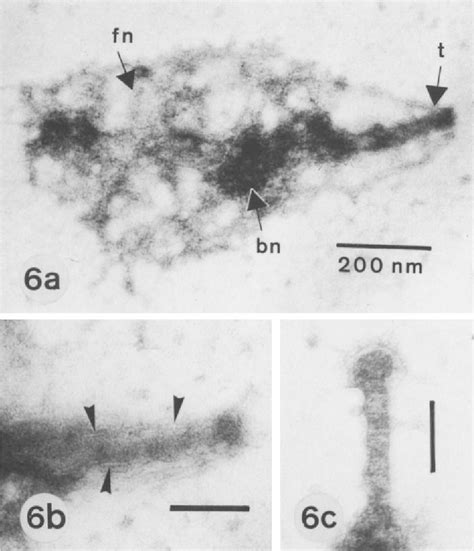 Figure 1 From Filamentous Structures In Adherent Mycoplasma Pneumoniae Cells Treated With