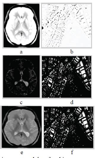 a new image fusion algorithm based on wavelet transform and adaptive neuro fuzzy logic approach