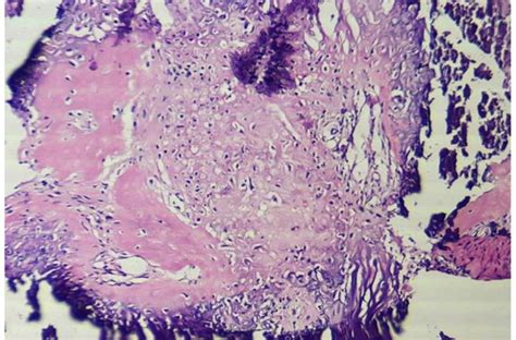 Under 40x Microscopy Histopathological Section Of Specimen Showing