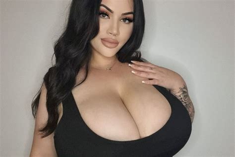 Mum Says Her Boobs Wont Stop Growing Due To Rare Condition And They