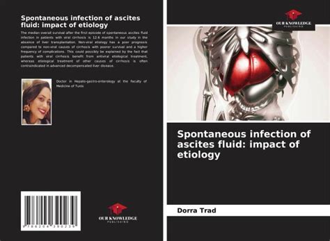 Spontaneous Infection Of Ascites Fluid Impact Of Etiology Von Dorra