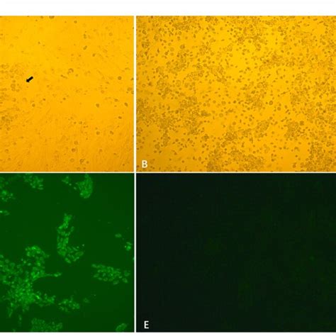Figure Transfection Results Of Diierent Treated Viral Dna And Plasmids Download Scientific