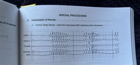 TMC Section E Flashcards Quizlet