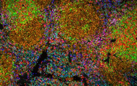 Multiplex Ihc Detection Kit Tsa Amplification Ab312827 Abcam