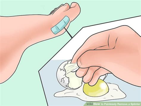 How To Painlessly Remove A Splinter Steps With Pictures