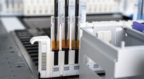 Tecan Streamlines Proteomics Workflows With Innovative Automation And