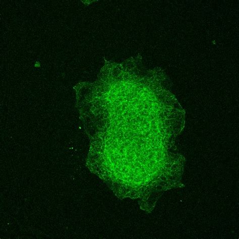 Quantification Of Fluorescence In 3d Spheroids Image Analysis Image