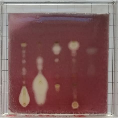 Thin Layer Chromatography TLC Bioautography