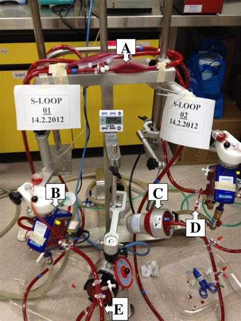 Ecmo Circuit