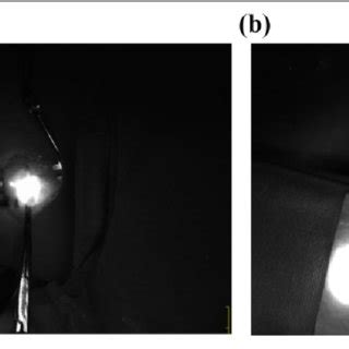 A Right Axillary Sentinel Lymph Node Identified With Fluorescence Download Scientific Diagram