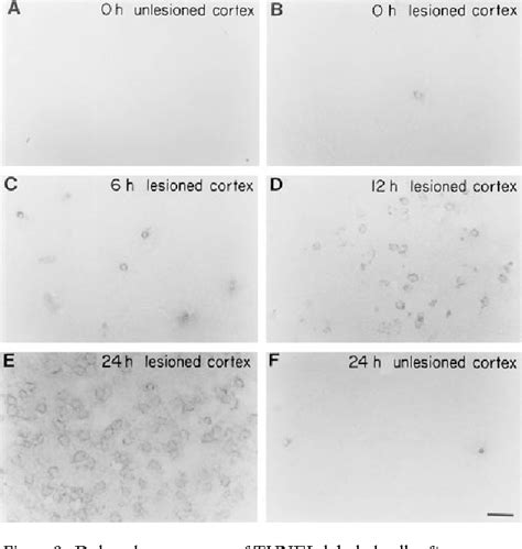 Neonatal Hypoxia Semantic Scholar
