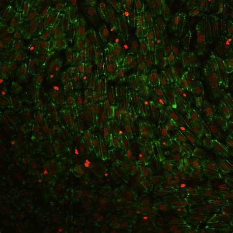 Transendothelial Migration Applications Nikon Bioimaging Lab
