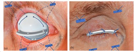 Illustration Rendering A Conformer In Place With A Double Armed Download Scientific