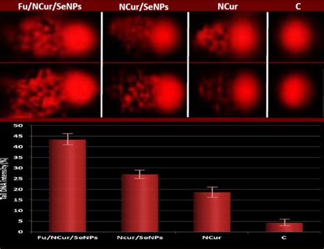The Anticancer Activity Of Fucoidan Coated Selenium Nanoparticles And Curcumin Nanoparticles