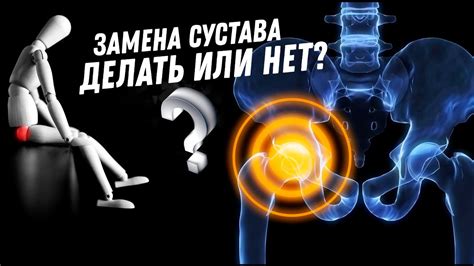 Операция Замены Сустава Эндопротезирование ДЕЛАТЬ или НЕТ Тренер Хапаев Youtube