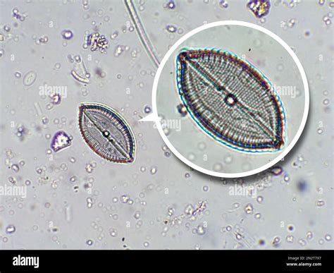 Will Diatom Algae Go Away At Claudia Aunger Blog
