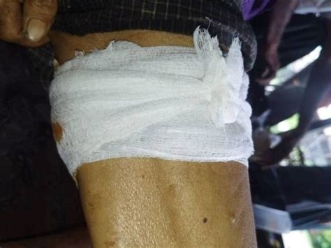 စစ်ကောင်စီတပ်က တိုက်ပွဲမရှိဘဲ လက်နက်ကြီးနဲ့ပစ်လို့ အမျိုးသမီး ၁ ဦးသေပြီး၊ ၃ ဦးဒဏ်ရာရ