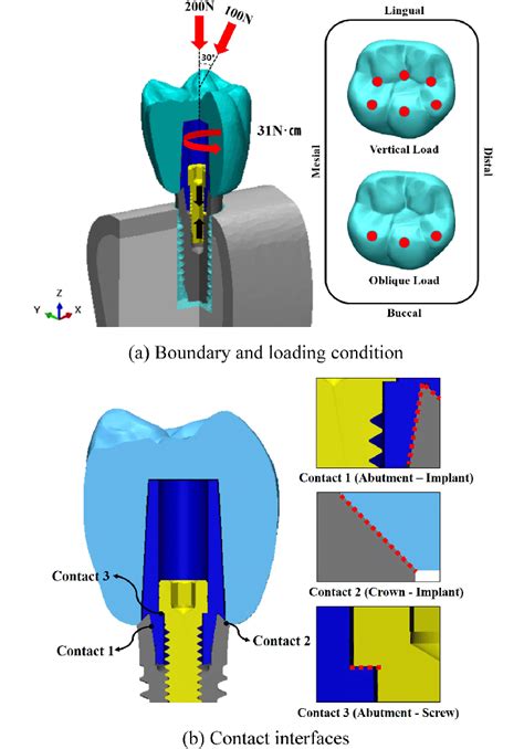 Finite Element Analysis Conditions Of All Cases Download Scientific Diagram