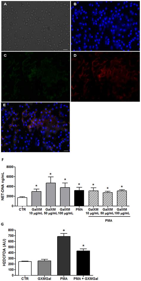Cryptococcus Neoformans Gxmgal Induces Net Release Human Neutrophils Download Scientific
