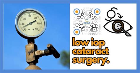 Corneal Ectasia Causes Symptoms Latest Treatments And Prevention